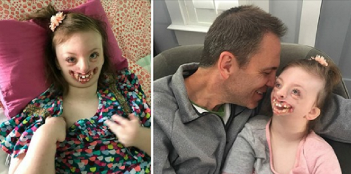 fille handicapée, Vivre Femme, portail feminin